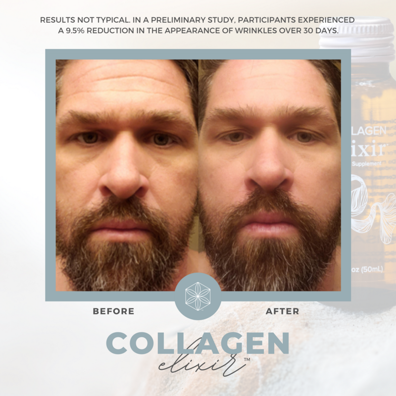 Collagen — ㅤ