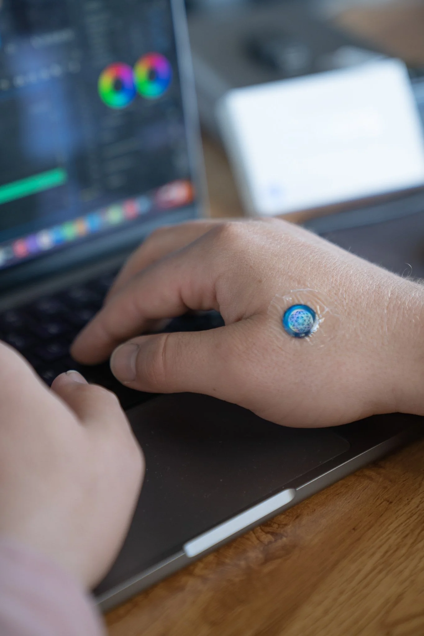 AO Scan Technology — Solex