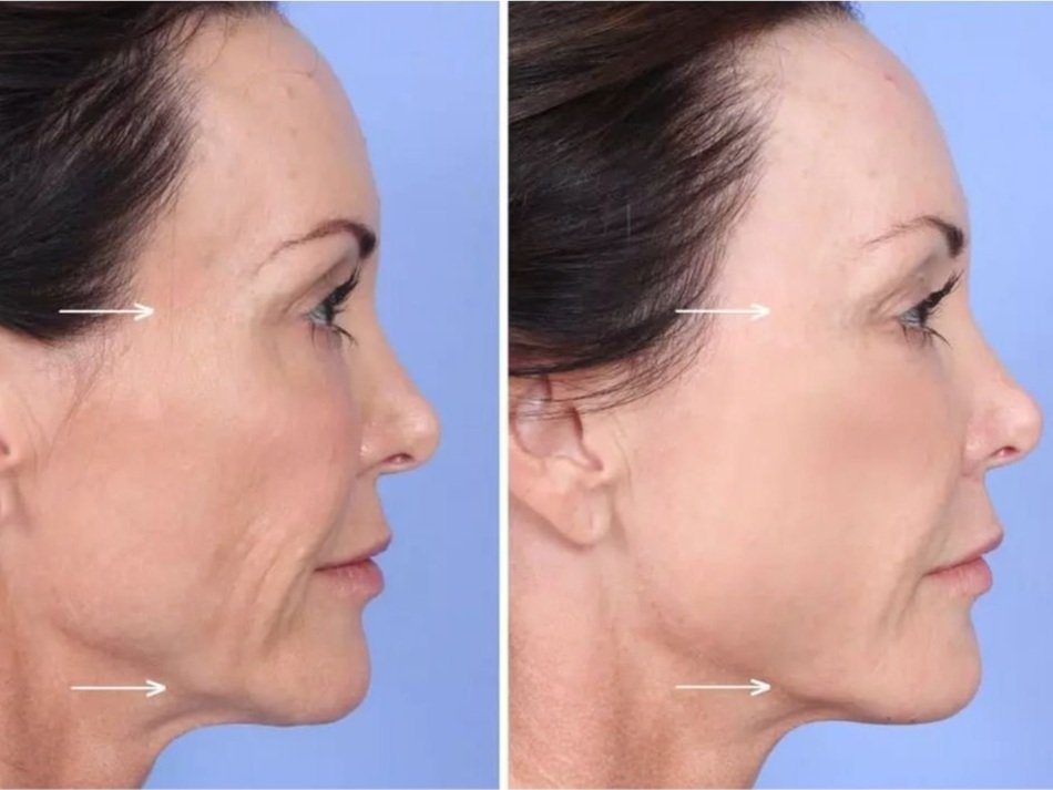 Medspa Fairhope AL | Aesthetics & Treatments | Southern Women's ...