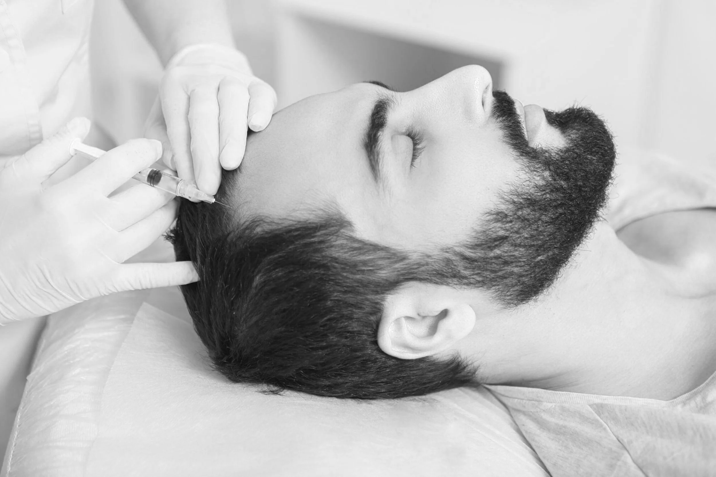 Mesoterapia capilar Dutasteride — Relief Dermatología y Estética