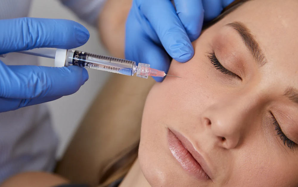 Bio-remodeling: Before & After Treatment — Clarion Medical Aesthetic Clinic