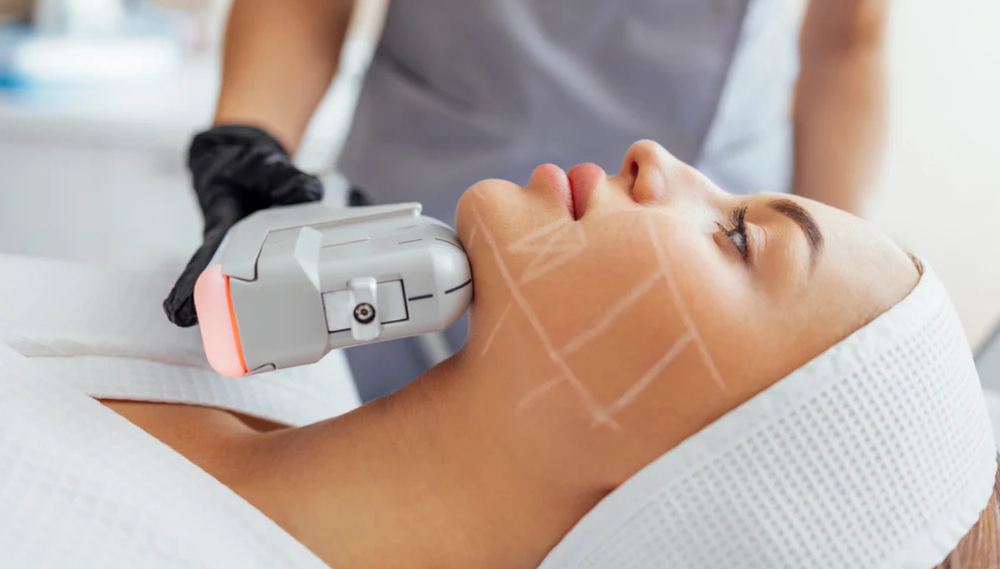 HIFU: Which Type of HIFU Should I Choose? — Clarion Medical Aesthetic Clinic
