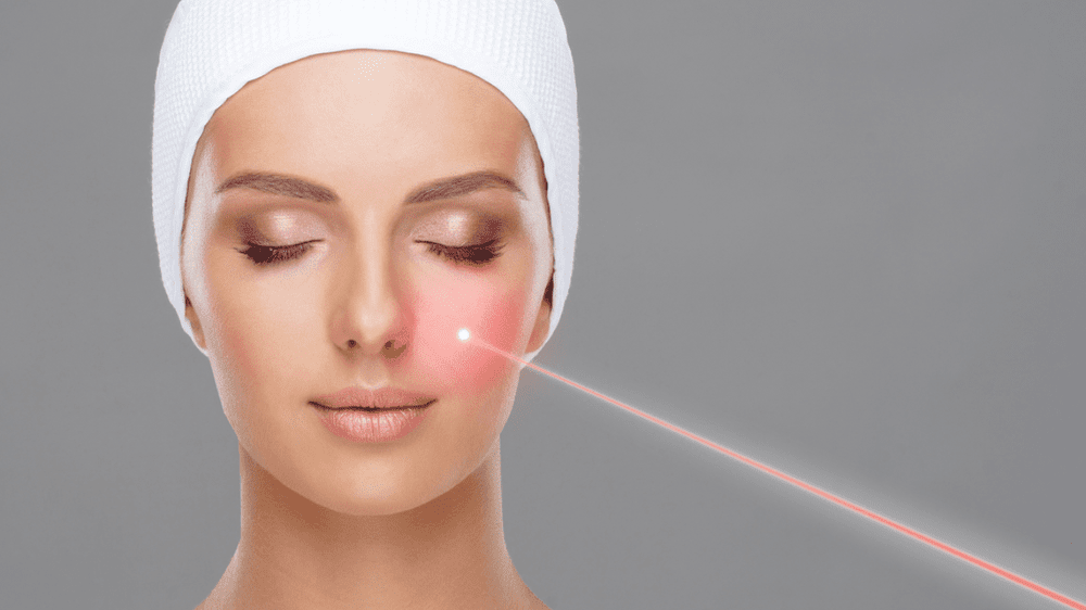 How Long to See Results From Pico Laser Treatments? — Clarion Medical ...