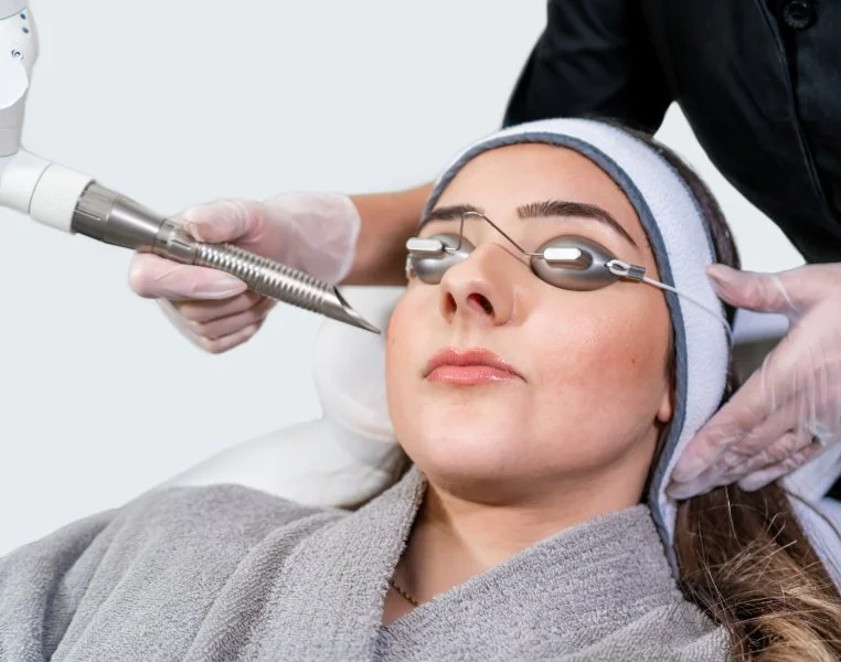 Pico Laser vs. Q-Switched Laser for Pigmentation Treatment — Clarion ...