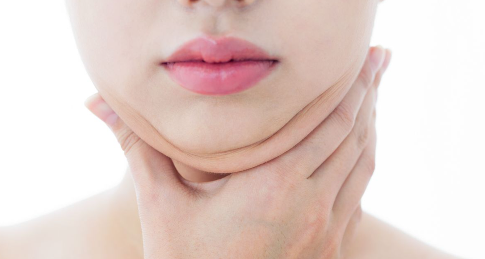 How to Get Rid of Double Chin — Clarion Medical Aesthetic Clinic