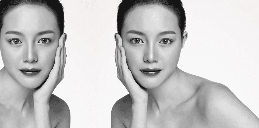 What Are the Side Effects of HIFU Treatment? — Clarion Aesthetics