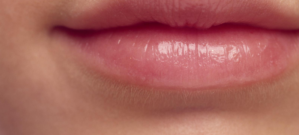 Lip Conditions and How Lip Fillers Can Treat Them — Clarion Medical ...