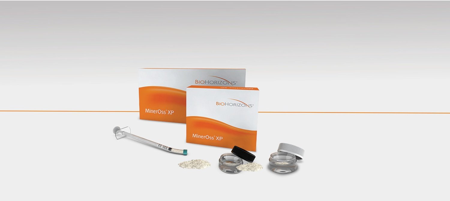 MinerOss BioHorizons Camlog Implant