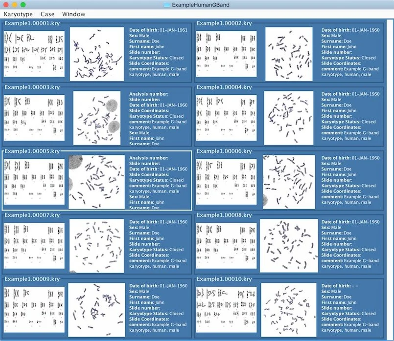 SmartType | Discover Karyotyping Ease