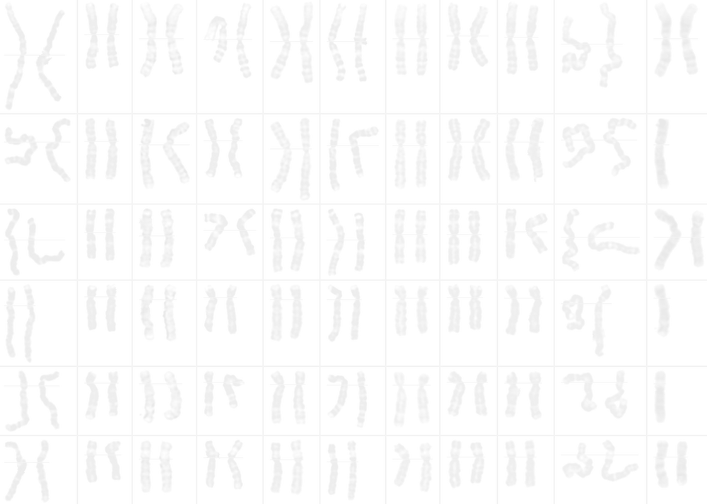 SmartType | Discover Karyotyping Ease