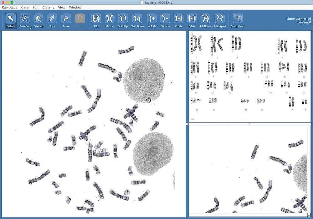 SmartType | Discover Karyotyping Ease