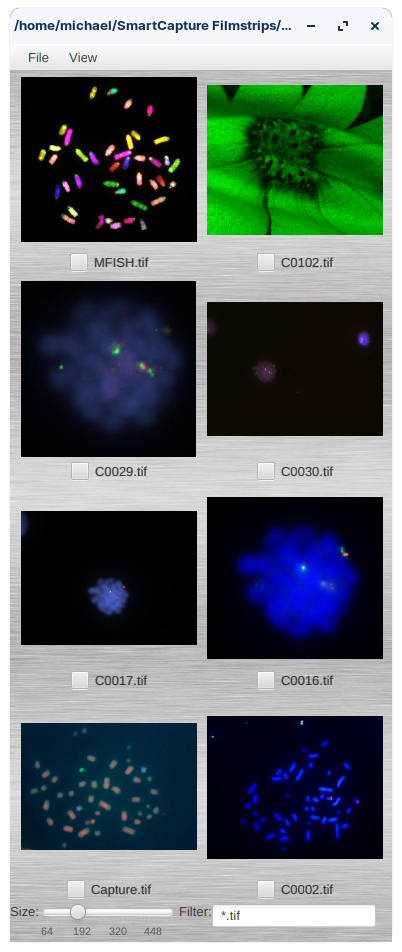Case View — SmartType