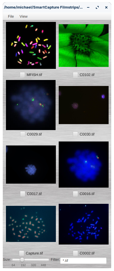 Case View — SmartType