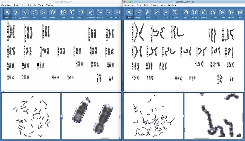 SmartType | Discover Karyotyping Ease