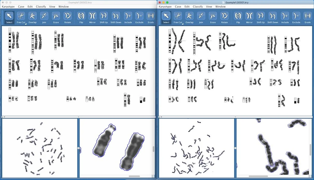 SmartType | Discover Karyotyping Ease