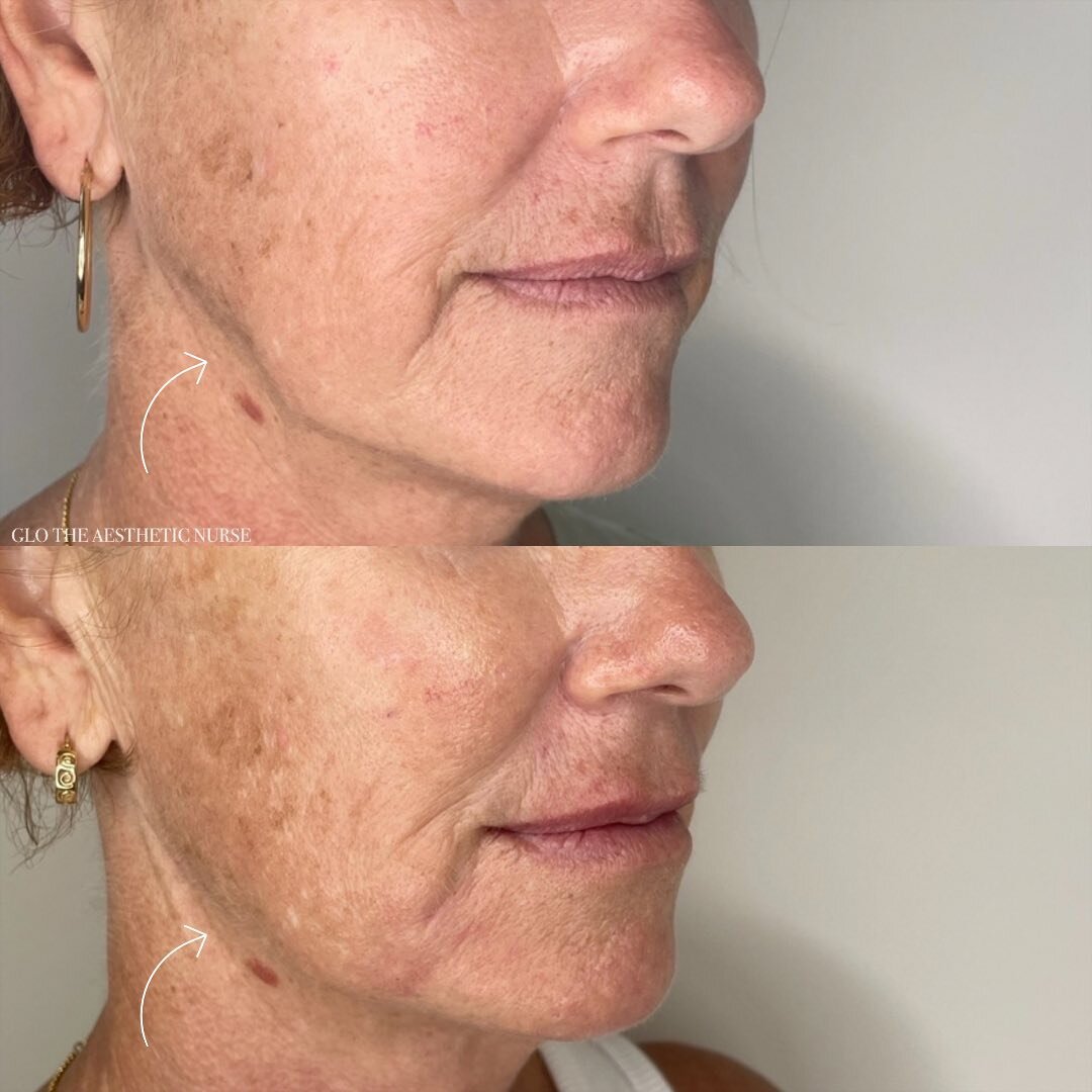 GLO. The Aesthetic Nurse