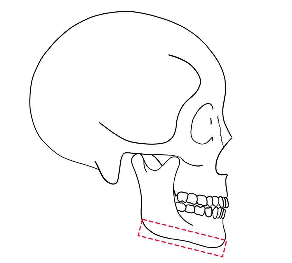 What is Condylar Resorption? — condylarresorption.org