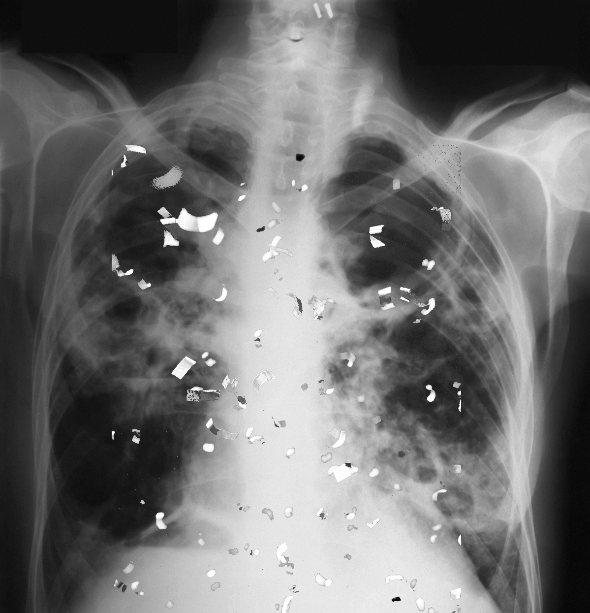 PolyGone - The Only Microplastic Filter for Rivers