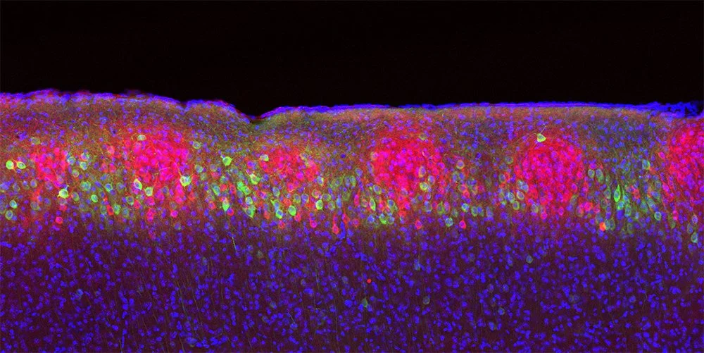 Takashi Kitamura Lab @ UTSW