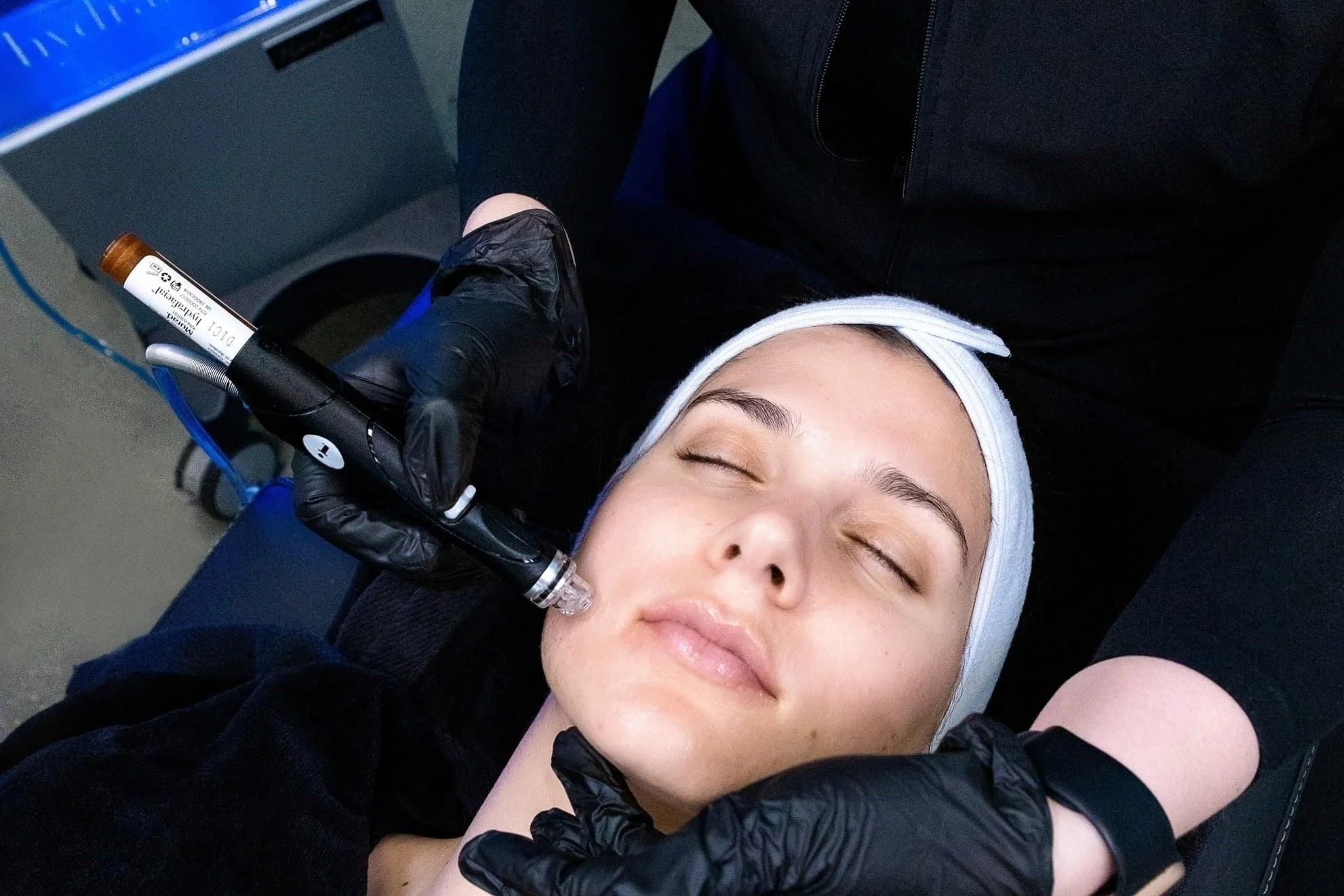 Blackheads & Treatments for Breakouts | SKINLAB Luxury Skin Clinic Deal
