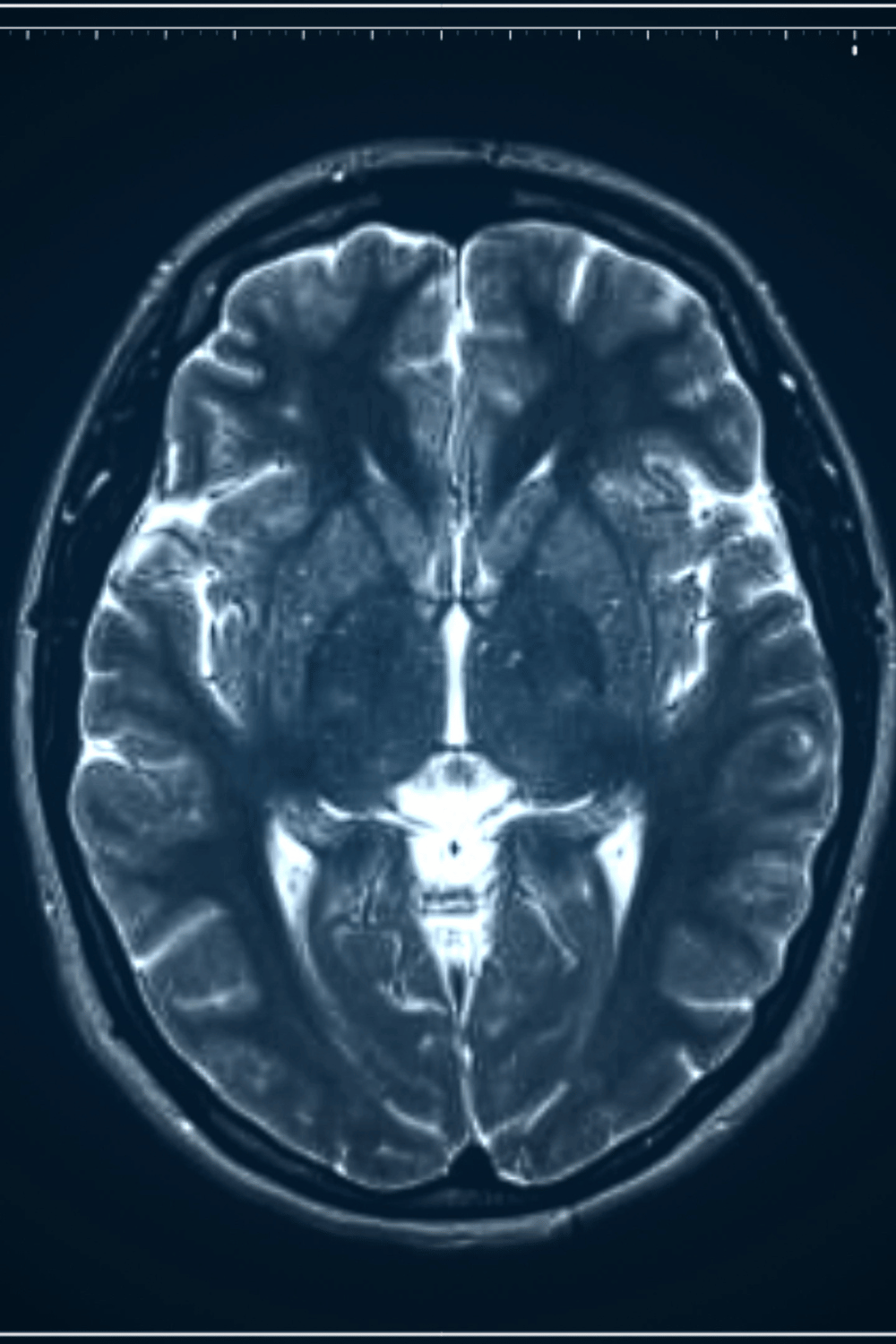 7 Principles of Neuroplasticity: Breaking Bad Habits & Boosting Your ...