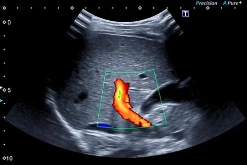 Paediatric Ultrasound Scans — East Anglia Ultrasound