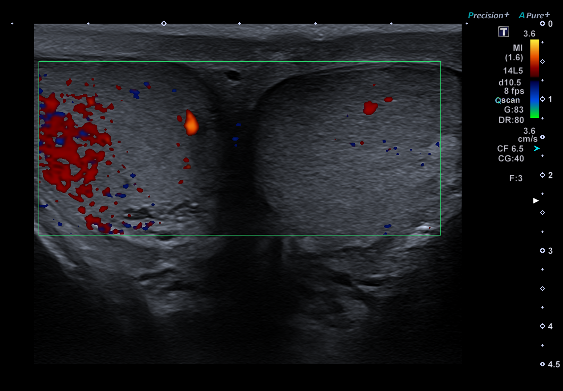scans for men — East Anglia Ultrasound