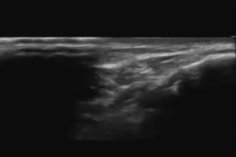 MSK - Musculoskeletal Scans — East Anglia Ultrasound
