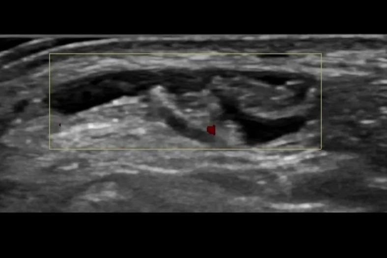 MSK - Musculoskeletal Scans — East Anglia Ultrasound MSK - Musculoskeletal Scans — East Anglia Ultrasound