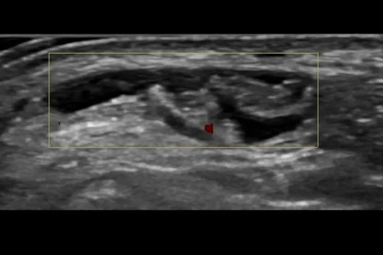 MSK - Musculoskeletal Scans — East Anglia Ultrasound