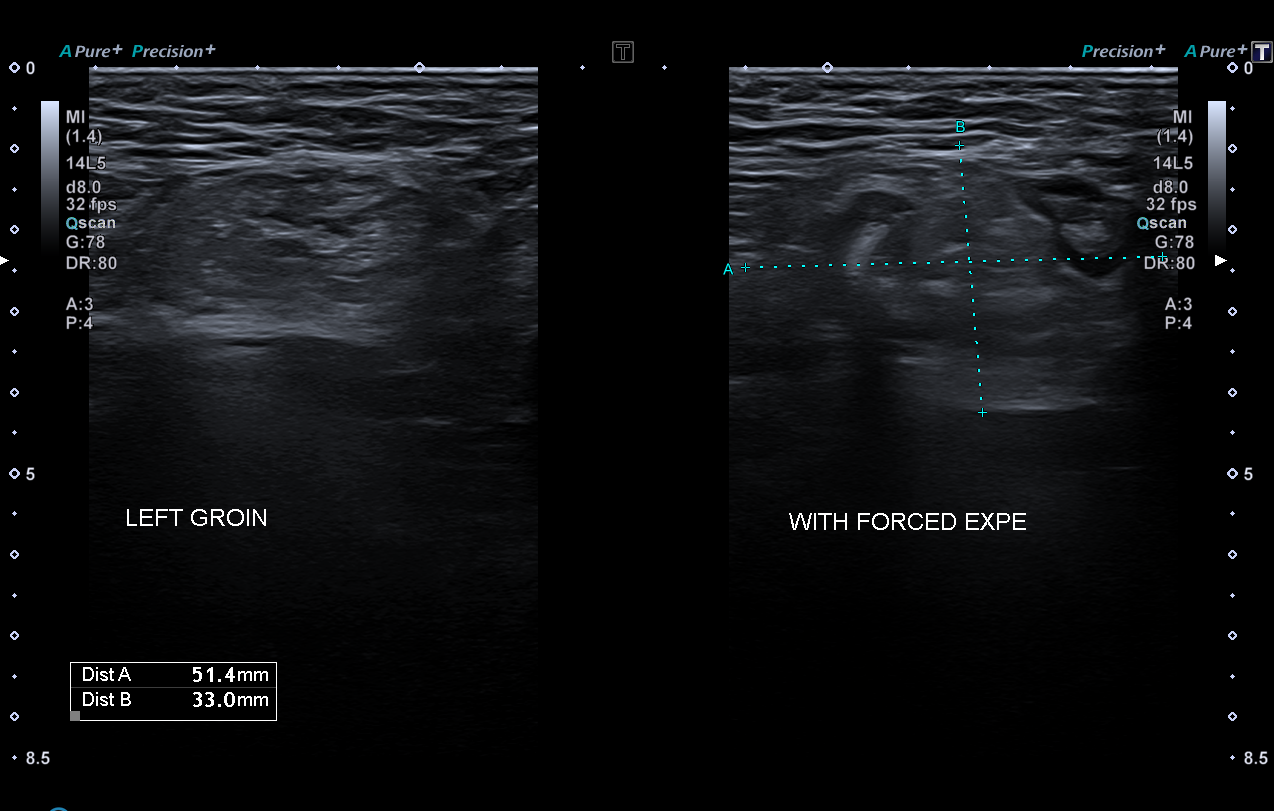 scans for men — East Anglia Ultrasound