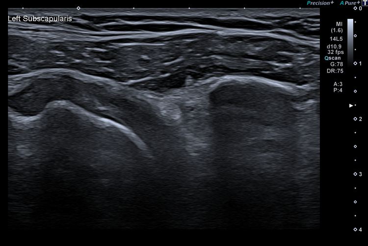 MSK - Musculoskeletal Scans — East Anglia Ultrasound