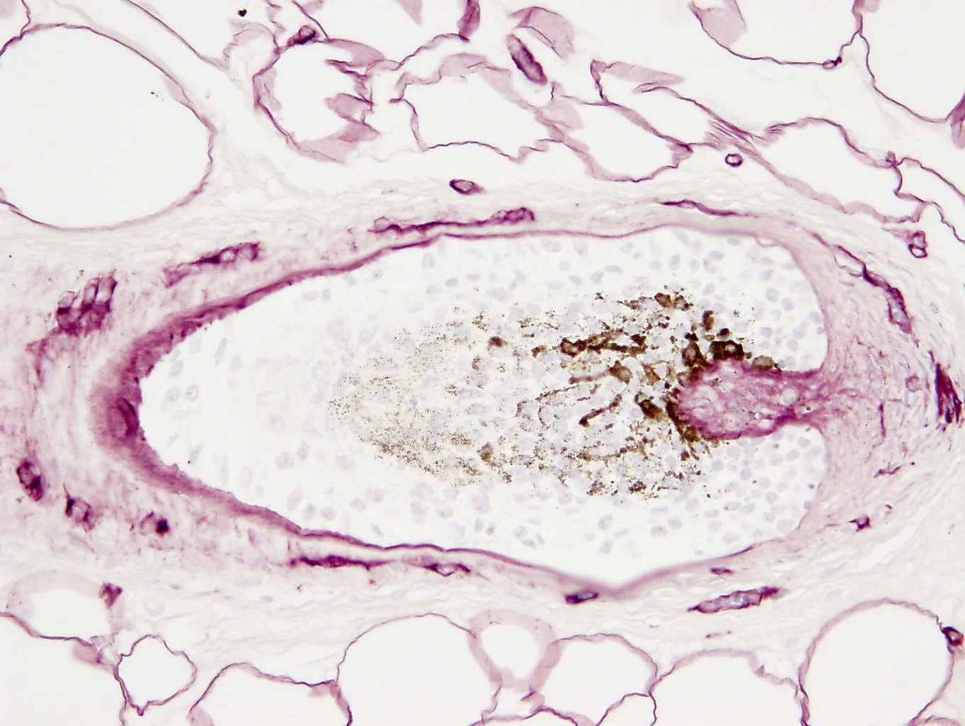 Our Science — Keraplast