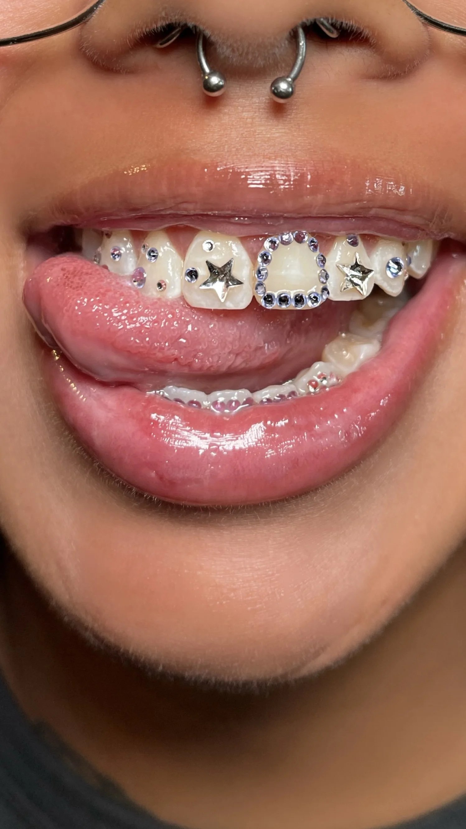 Miami Tooth Gems