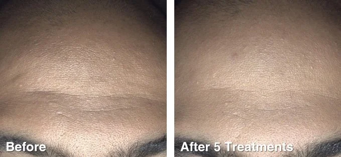 DoPro Healthcare Solutions — The Global Beauty Group - Cutera - Global ...