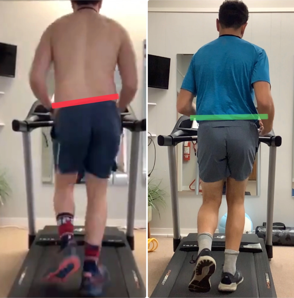 Case Study: Gait Retraining for Running Performance — The Run Rx