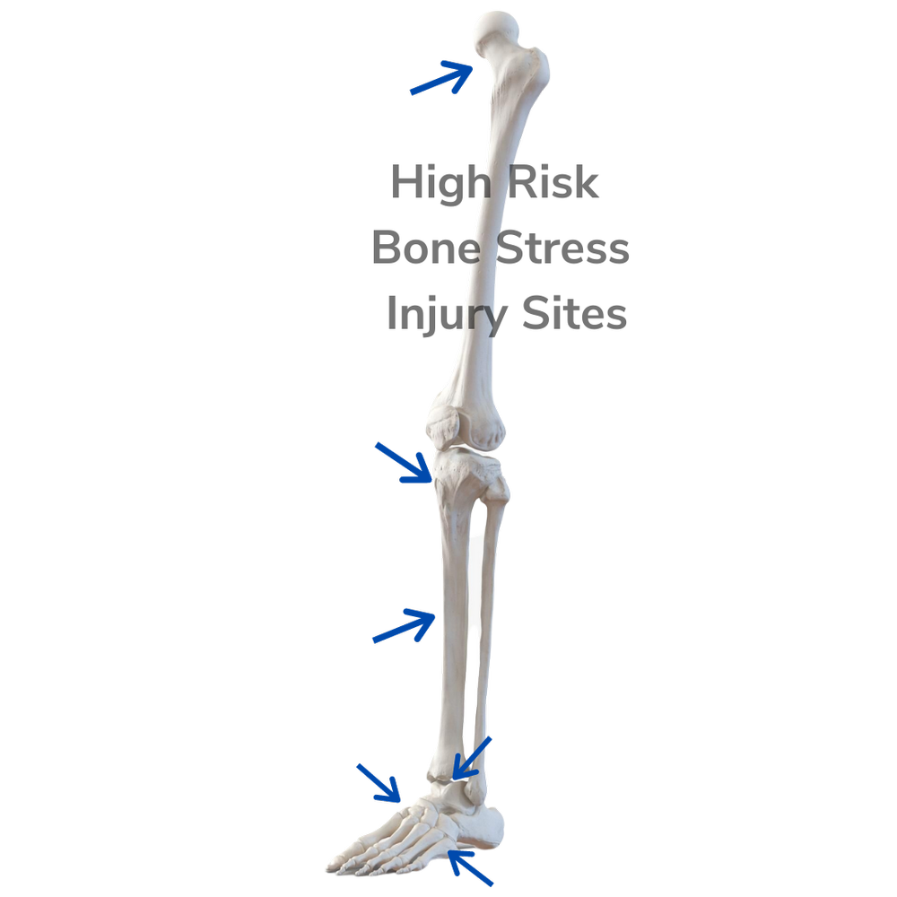 Running Through Pain and Running Injury Management — The Run Rx