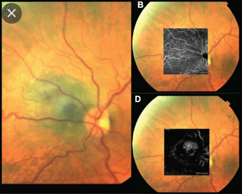 Kitchener Eyecare | Helping you see your best | Since 1899 | Optometrist in Kitchener, Eye ...