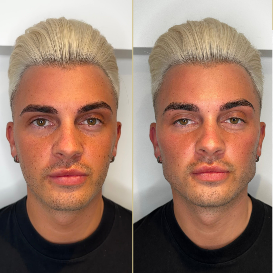Dr Ed Robinson Aesthetics Altrincham Manchester Cheshire