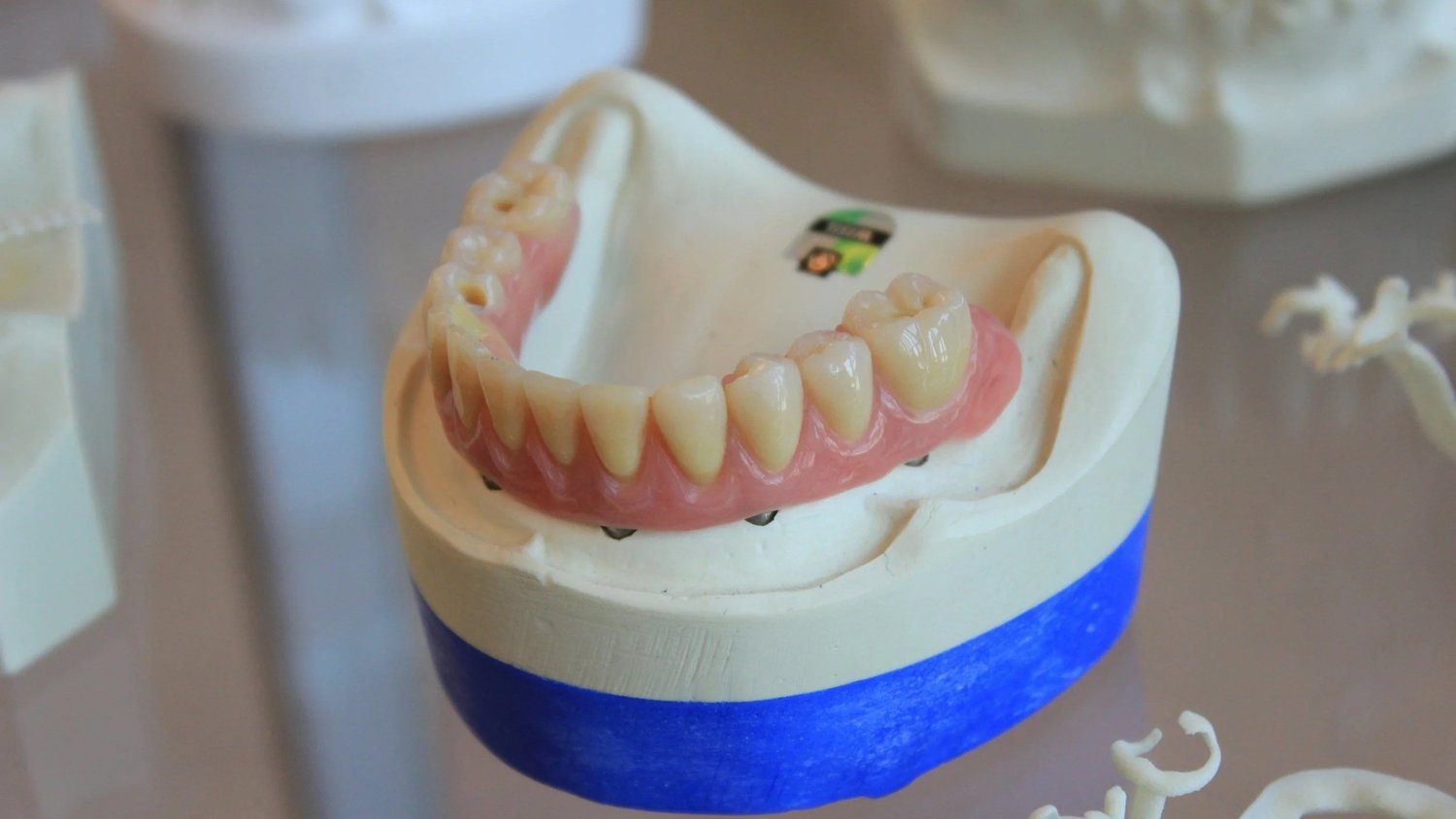From Temporary to Permanent: A Guide to Fake Teeth