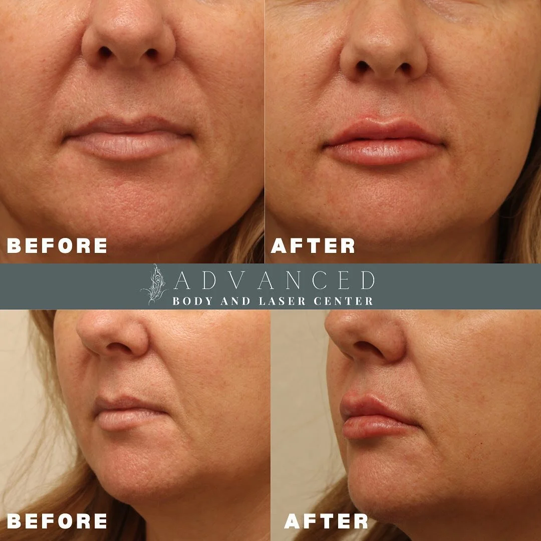 Advanced Body & Laser Center