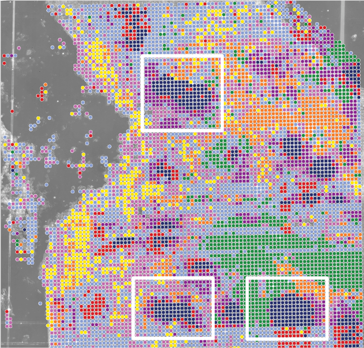 Spatial Epigenomics — Spatial ATAC-seq — AtlasXomics