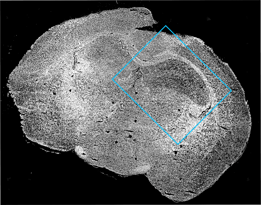 Spatial Epigenomics — AtlasXomics