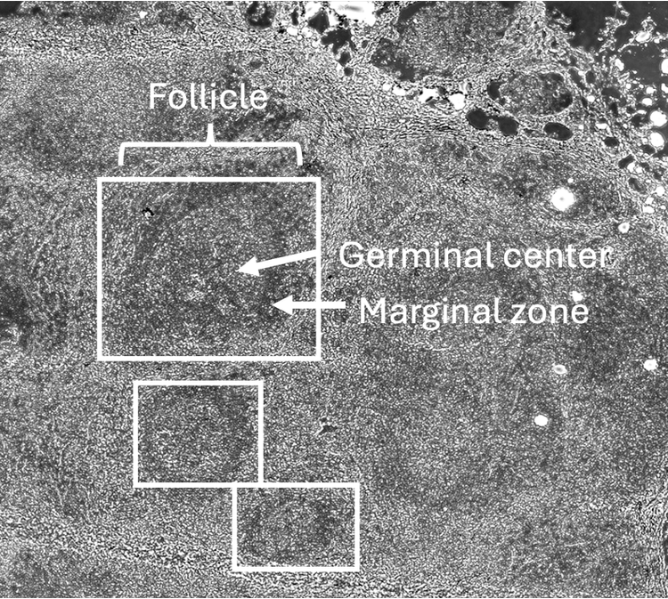 Spatial Epigenomics — Spatial ATAC-seq — AtlasXomics