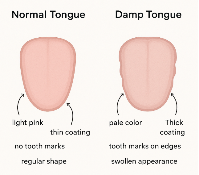 Understanding Dampness in the Body: A TCM Explanation — Open Care ...