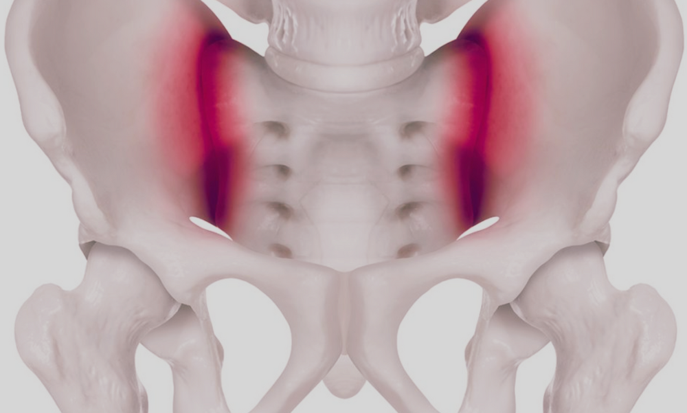 Sacroiliac Joint Fusion — SARC