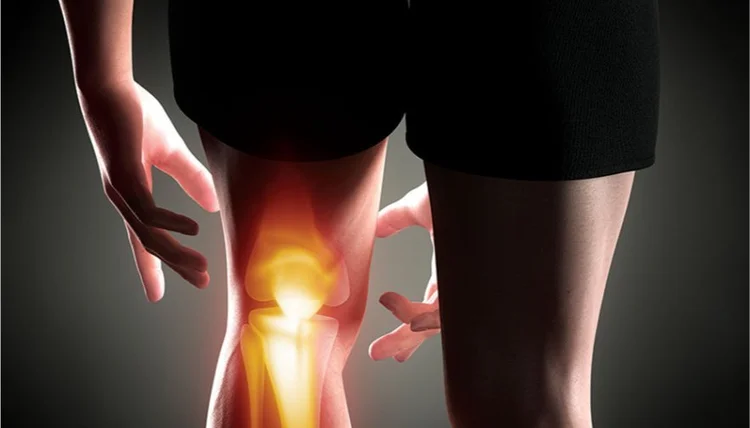 Knee Arthroscopy — SARC