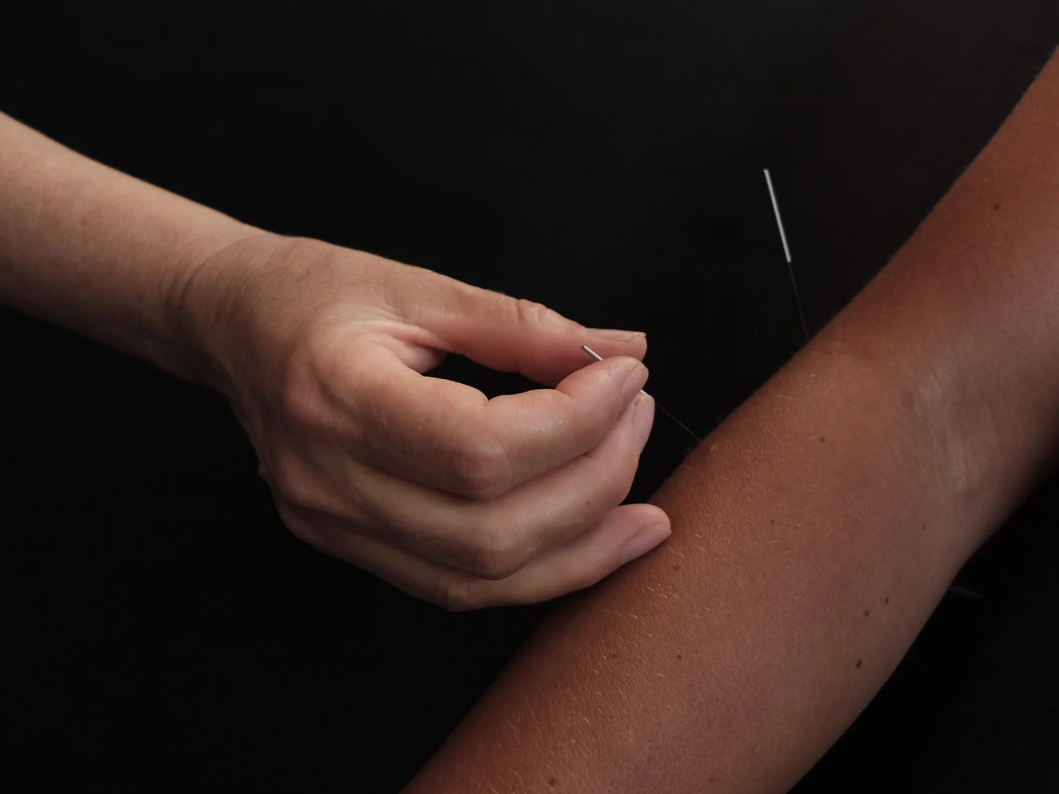 Public Health Acupuncture New Mexico