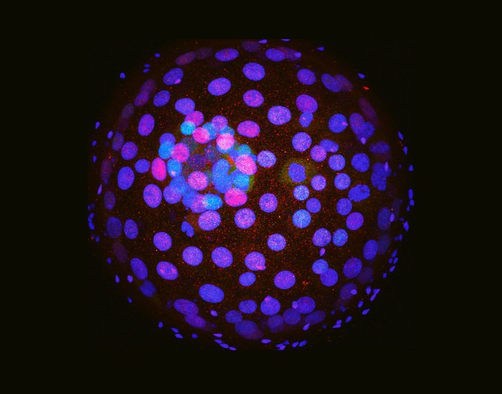 Early Development — HDBI - Human Development Biology Initiative