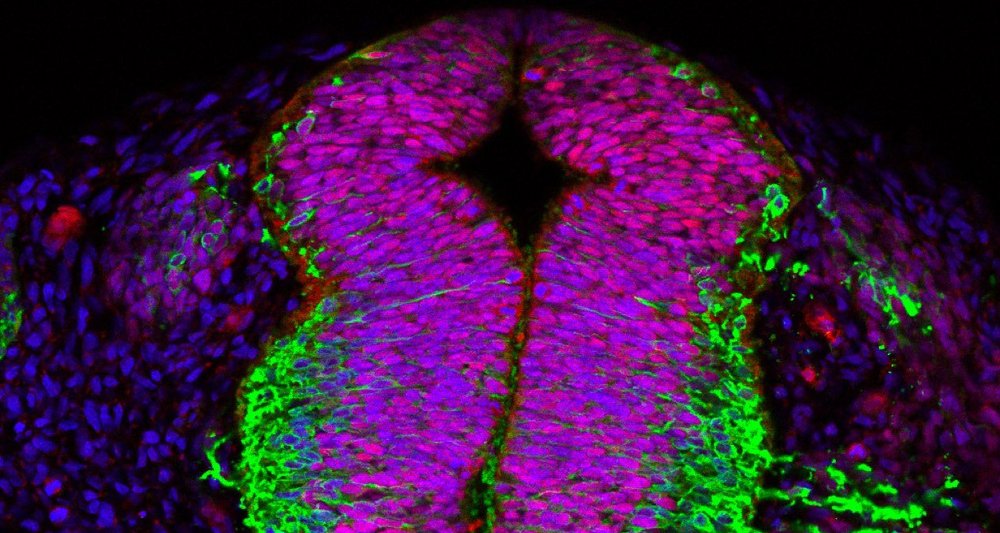 Neural Development — HDBI - Human Development Biology Initiative